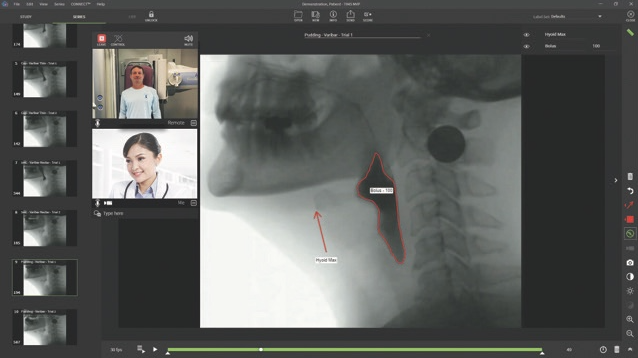 TIMS Medical Releases TIMS Connect | MedWrench