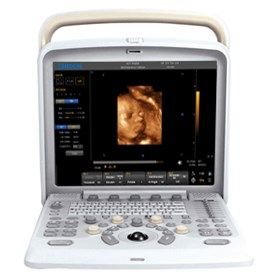 Chison Q5 Manual | PDF | MedWrench