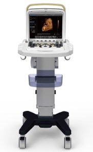 Chison Q5 Manual | PDF | MedWrench