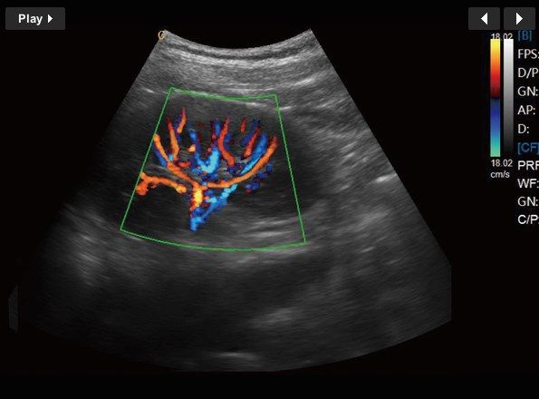 Chison Q5 Manual | PDF | MedWrench