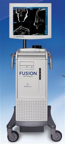 Medtronic Fusion ENT Quick Reference Guide | PDF | MedWrench