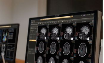 Philips - IntelliSpace Portal 9.0 Community, Manuals and Specifications ...