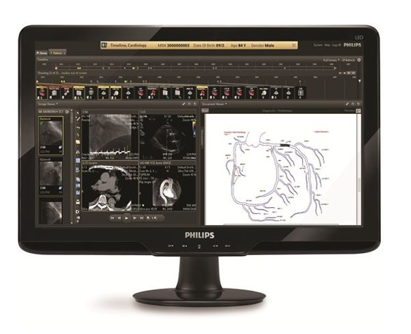 Encapsulated PDFs - Philips IntelliSpace Cardiovascular | MedWrench