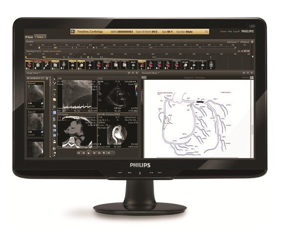 Picture Archiving and Communication System (PACS) Models, Products and ...