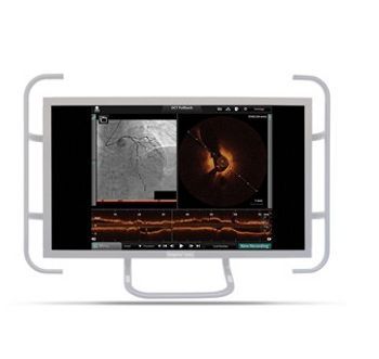 Abbott Medical Optics - OPTIS Integrated System Community, Manuals and ...