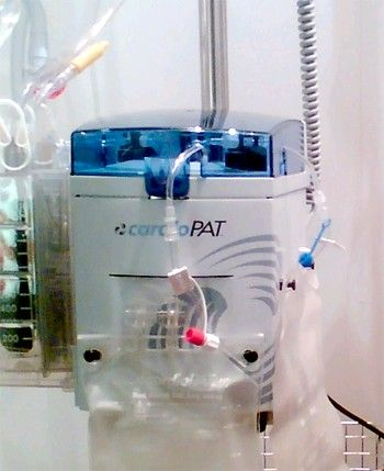 Haemonetics cardioPAT News Articles | MedWrench