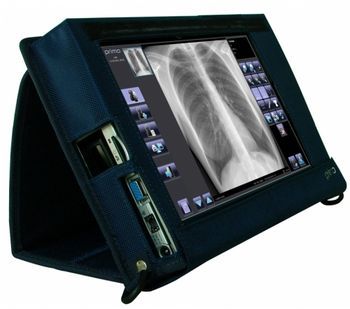 PrimaX International - Primo with add on Community, Manuals and ...