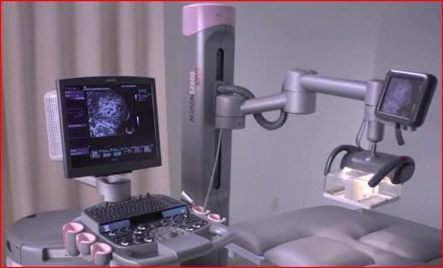 Siemens - Acuson S2000 - Siemens Acuson S2000 ABVS | MedWrench