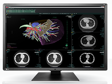 Eizo - RadiForce RX660 Community, Manuals and Specifications | MedWrench