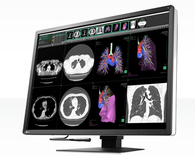Eizo RadiForce RX1270 Brochure.pdf | PDF | MedWrench