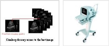 SIUI - CTS-3300 Community, Manuals and Specifications | MedWrench