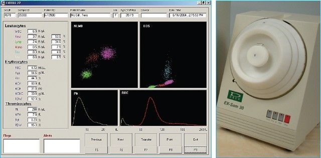 Hematology Analyzer Drew Scientific Group 2280 Videos | MedWrench
