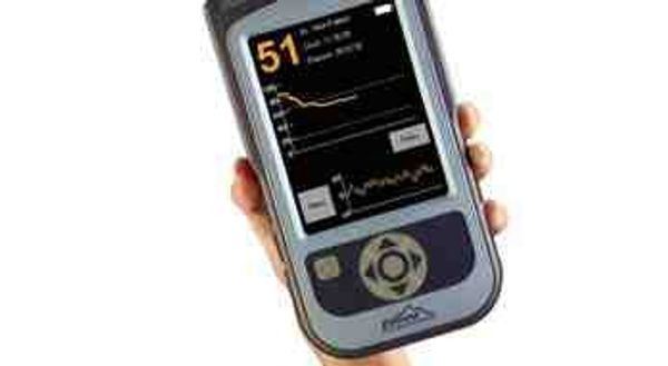 Stryker SNAP II Monitor - Stryker Snap II | MedWrench