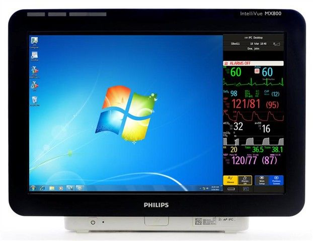 Charting Length Issue - Philips IntelliVue MX800 | MedWrench