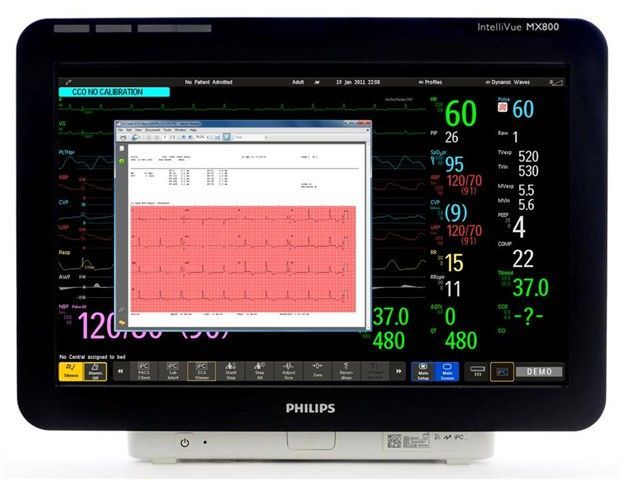 XDS Rev H.15 for MX800/iPC available for download - Philips IntelliVue ...