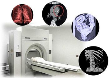 Imatron - Ultrafast Community, Manuals and Specifications | MedWrench