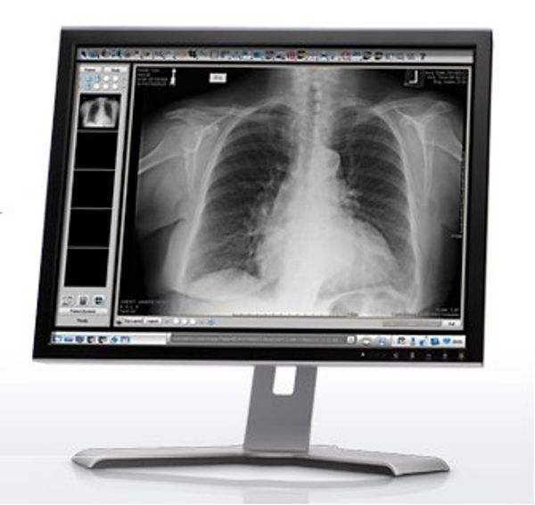 Carestream Now Taking Orders For Its Enhanced CR Image Acquisition/Mini ...