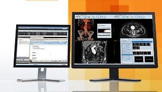 Picture Archiving and Communication System (PACS) Models, Products and ...