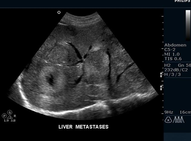 HD 11XE IS PRINTING DARKER THAN THE OTHERS USG'S MACHINES - Philips ...
