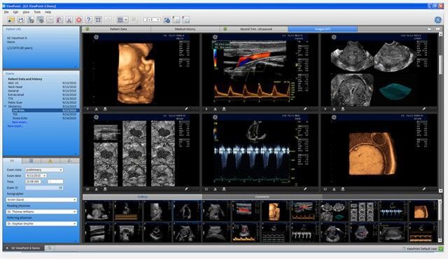 Picture Archiving and Communication System (PACS) GE Healthcare ...