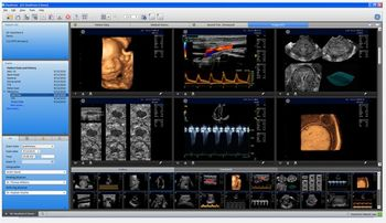 GE HealthCare - ViewPoint Community, Manuals and Specifications | MedWrench