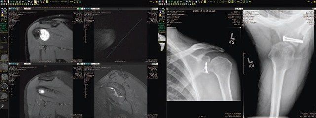 Viztek Opal-RAD PACS specs | PDF | MedWrench