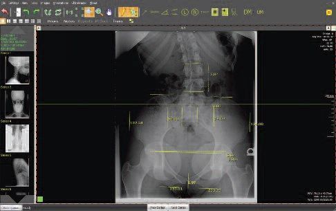 Viztek Opal-CHIRO PACS solution | PDF | MedWrench