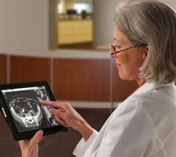 IntelliSpace Portal for assessment of cartilage - Philips IntelliSpace ...