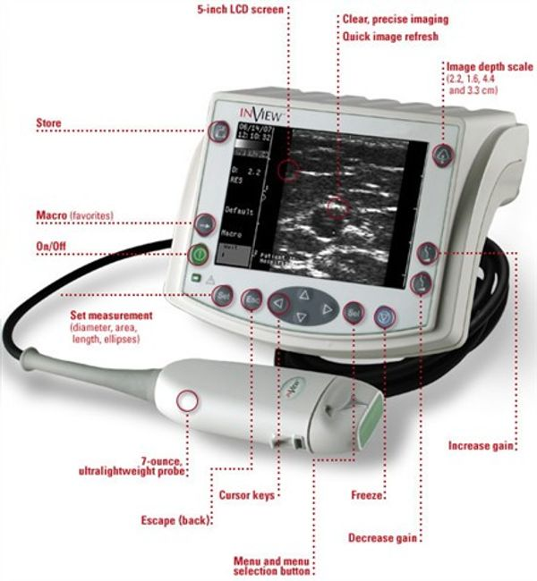 Arrow InView Ultrasound - Teleflex Medical ARROW InView Ultrasound ...