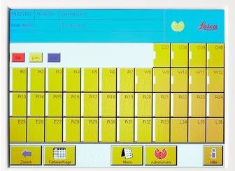Leica Biosystems ST5020 Multistainer Supplemental Sheet | PDF | MedWrench